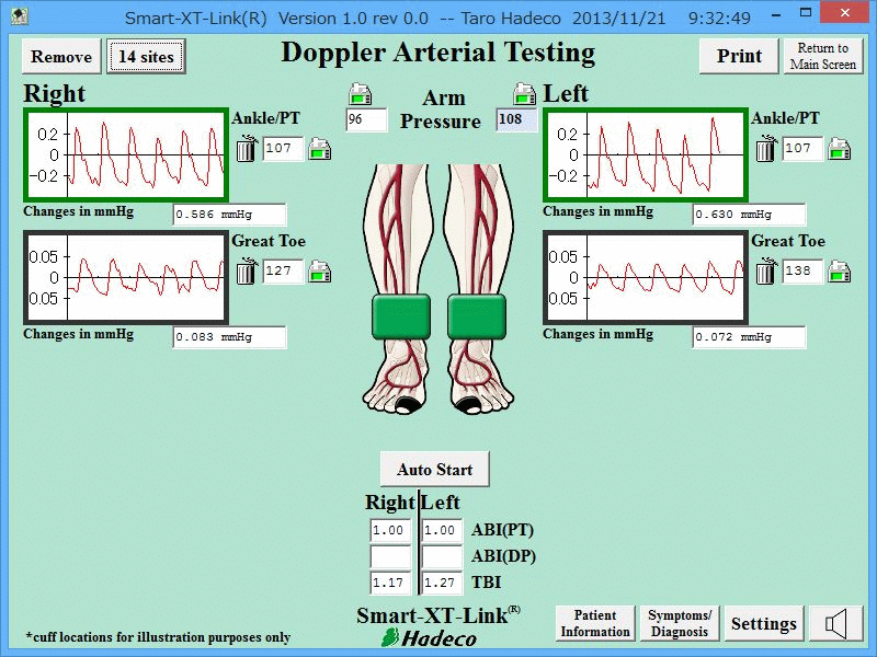 Smartdop XT | Products | Hadeco, Inc.